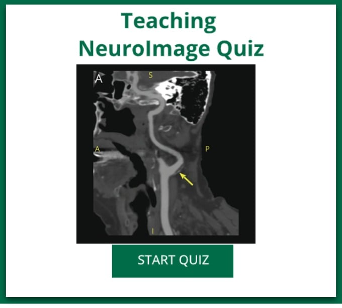 Neurology Resident and Fellow Section Teaching NeuroImage Quiz ...
