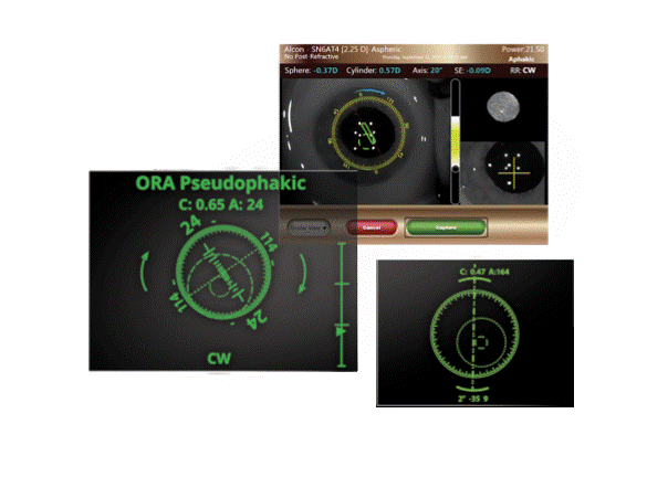 Argos | Alcon ????????????? | MyAlcon Professional