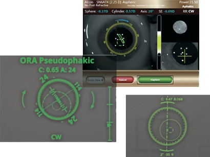 Argos | Alcon ????????????? | MyAlcon Professional