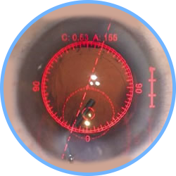 Argos | Alcon ????????????? | MyAlcon Professional