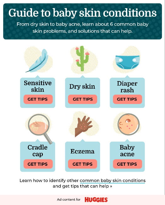 Huggies - Guide to Baby Skin Conditions IBE - Emmas Diary UK - Scale to ...