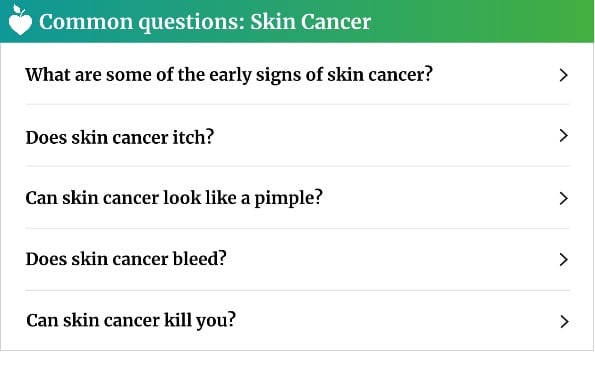 Common questions: Skin Cancer