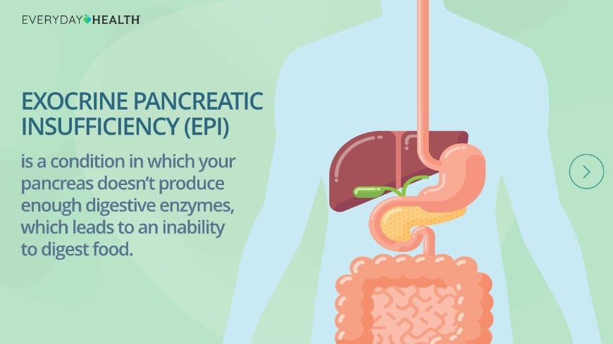 PERT Consumer’s Guide Timeline