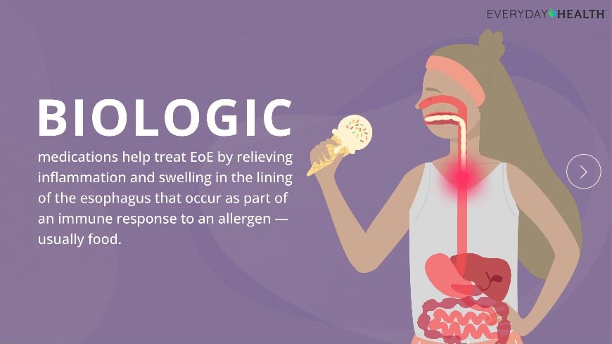 Consumers Guide Biologics for EoE Animation