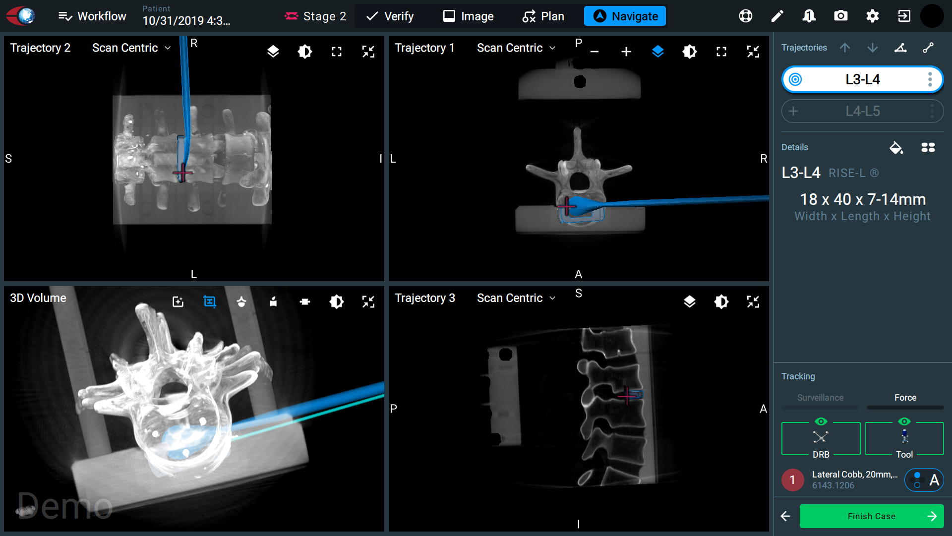 ExcelsiusGPS Interbody Solutions