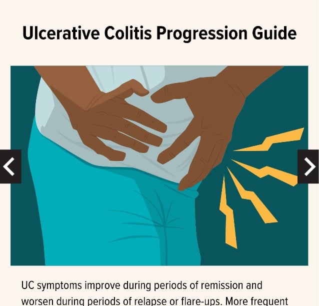HL Ulcerative Colitis Progress Guide Ulcerative Colitis Progression Guide