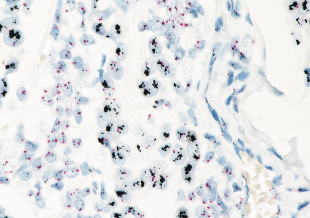 Breast Cancer Innovation - Going Further Breast Cancer Innovation ...